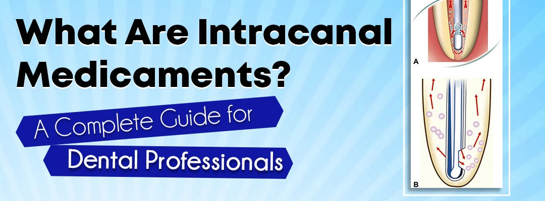 What Are Intracanal Medicaments? A Complete Guide – Dental Avenue